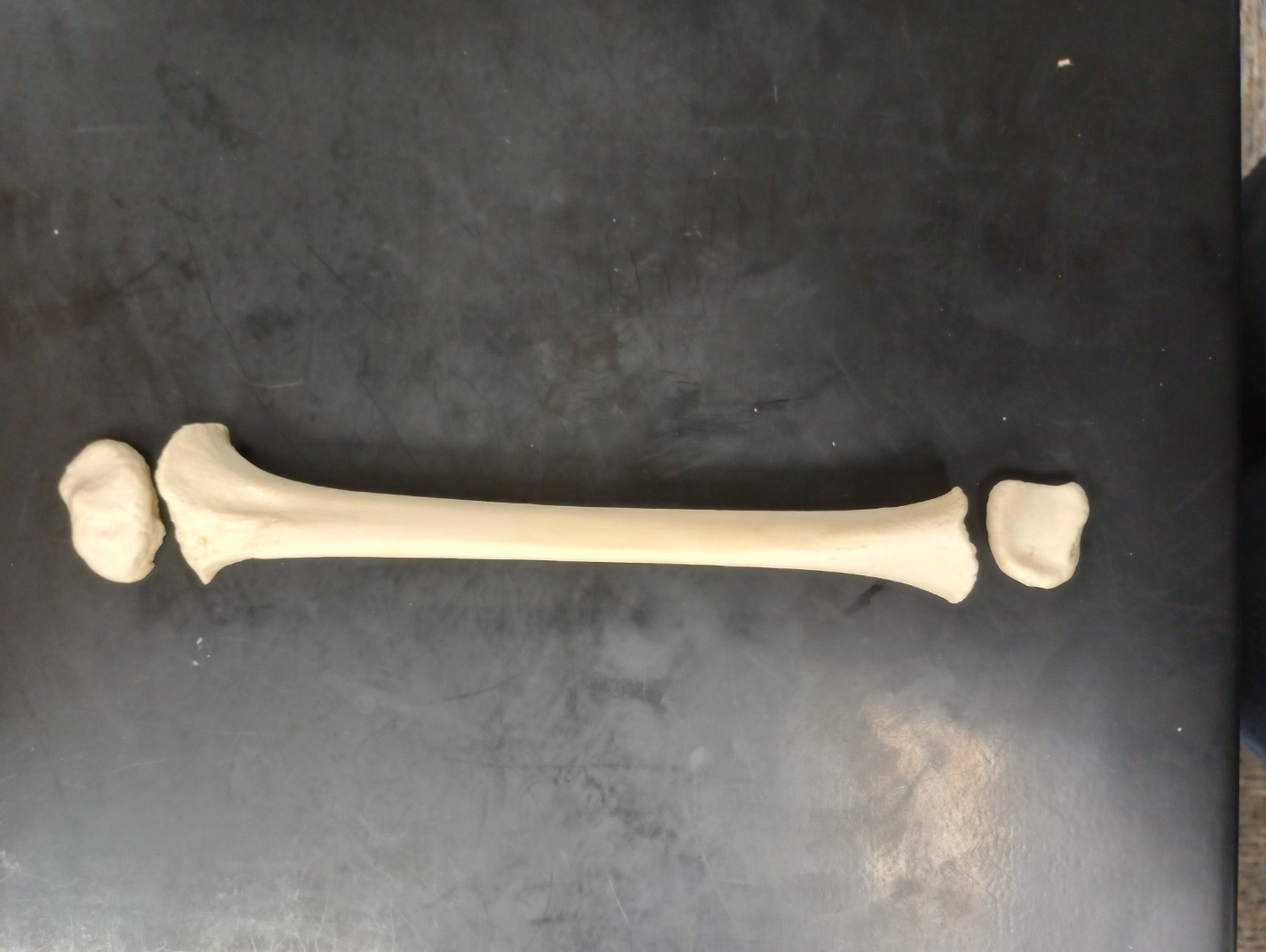 Chapter 12: Estimating Age in Human Skeletal Remains – PPSC ANT 2315 ...